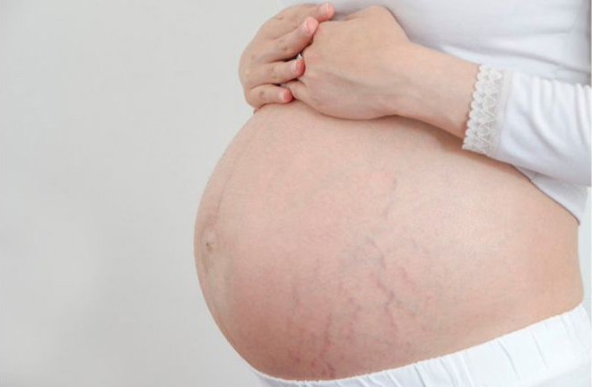What to expect from your skin when you're expecting - Skinsmart ...